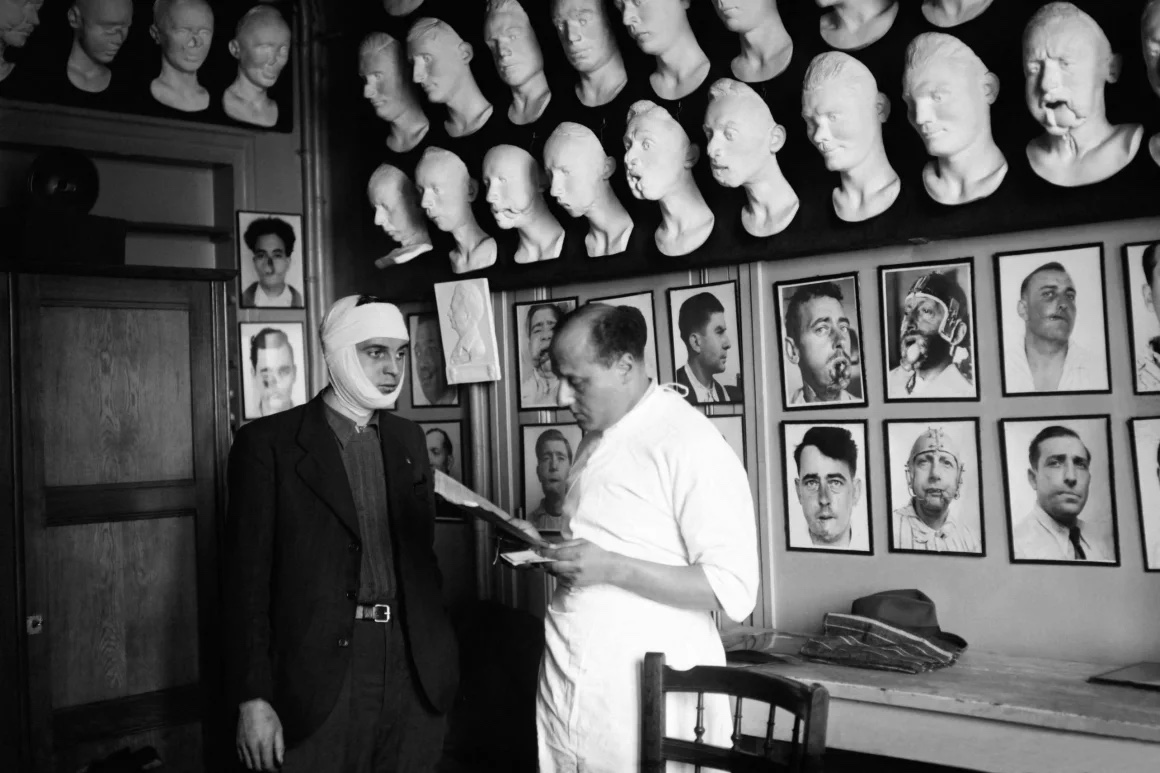 Under the Knife: The Rise of Modern Plastic Surgery | The York Historian